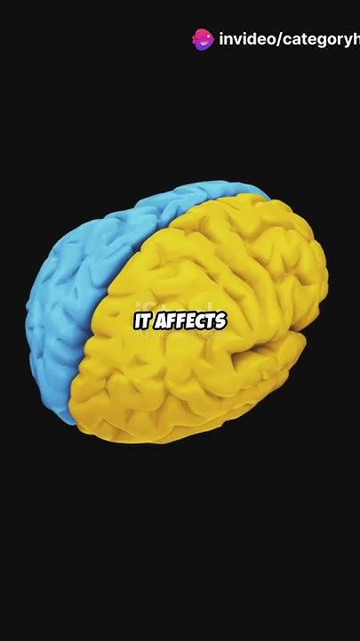 How does Anesthesia affect your brain? (In video AI) #shorts #invideoai ...