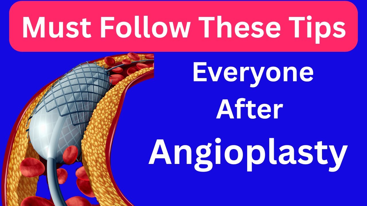 Precautions After Angioplasty Explained By Cardiologist#2026 #food # ...