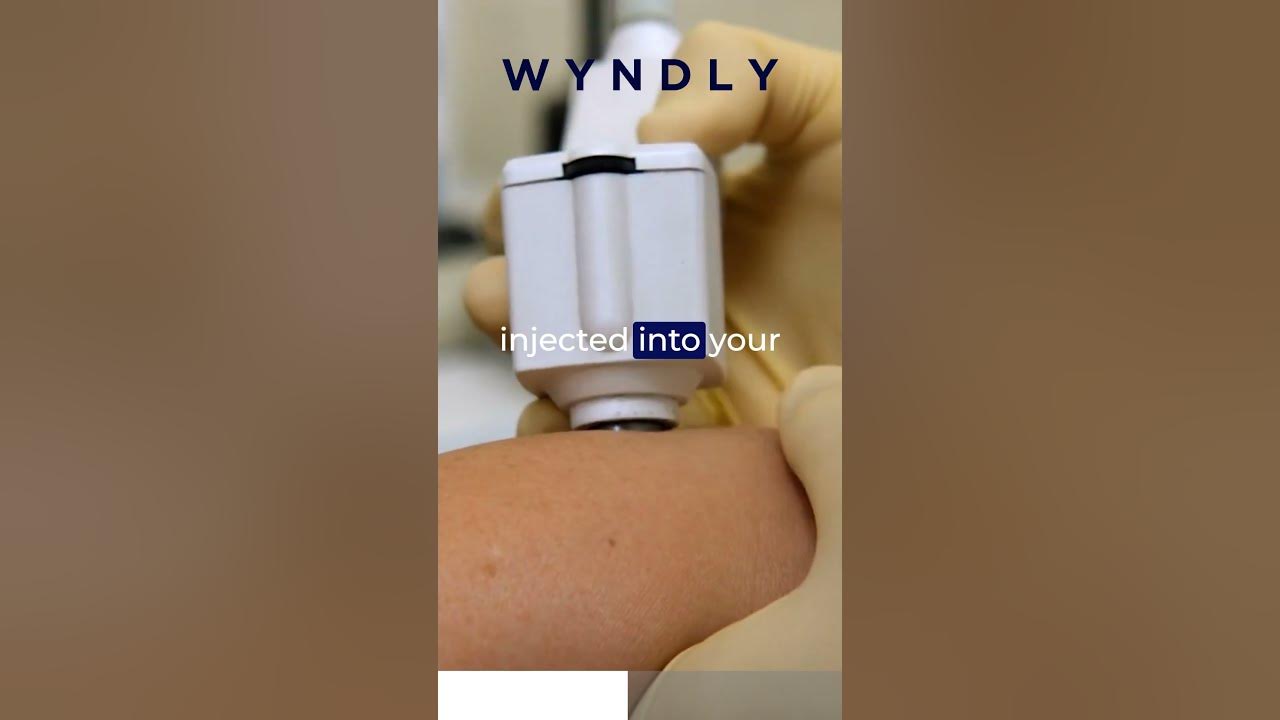 What Is Intradermal Allergy Testing Allergy Allergies Healthadvice