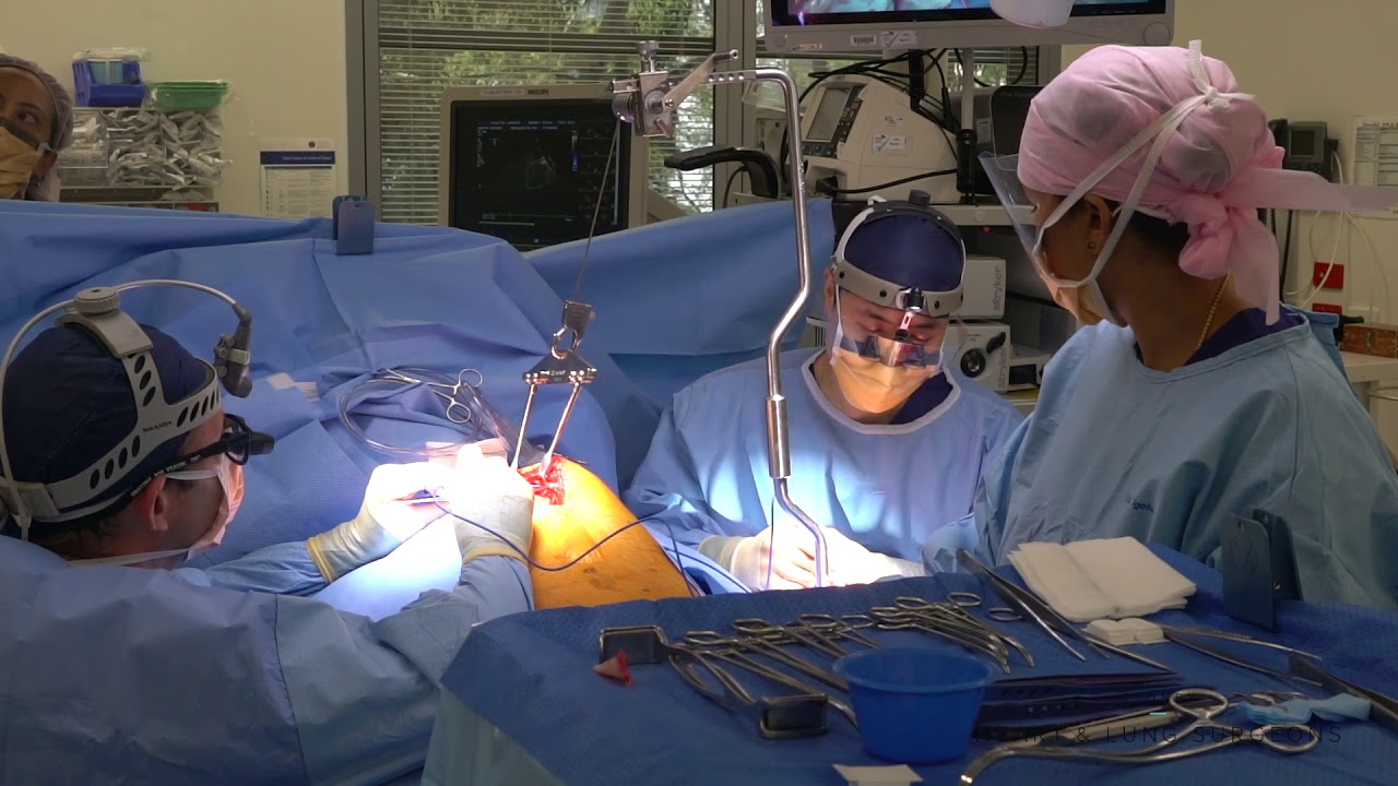 2. Radial artery harvest - YouTube
