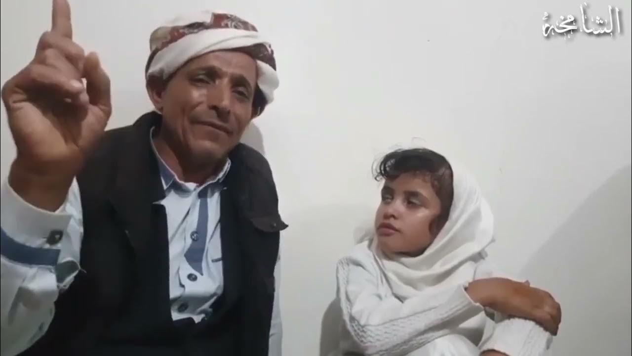 طفلة يمنية تعرضت للتعذيب الوحشي على يد أبيها وأقربائها حتى فقدت النظر