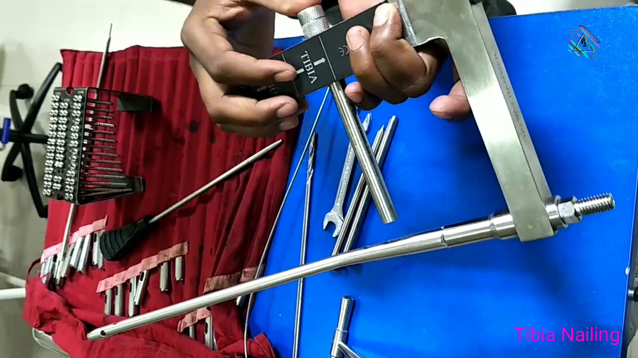 Tibia nailing instrument and implant with steps... - YouTube