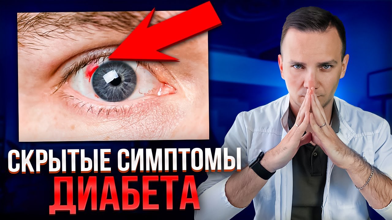 Это первые признаки ДИАБЕТА Как вовремя распознать САХАРНЫЙ ДИАБЕТ