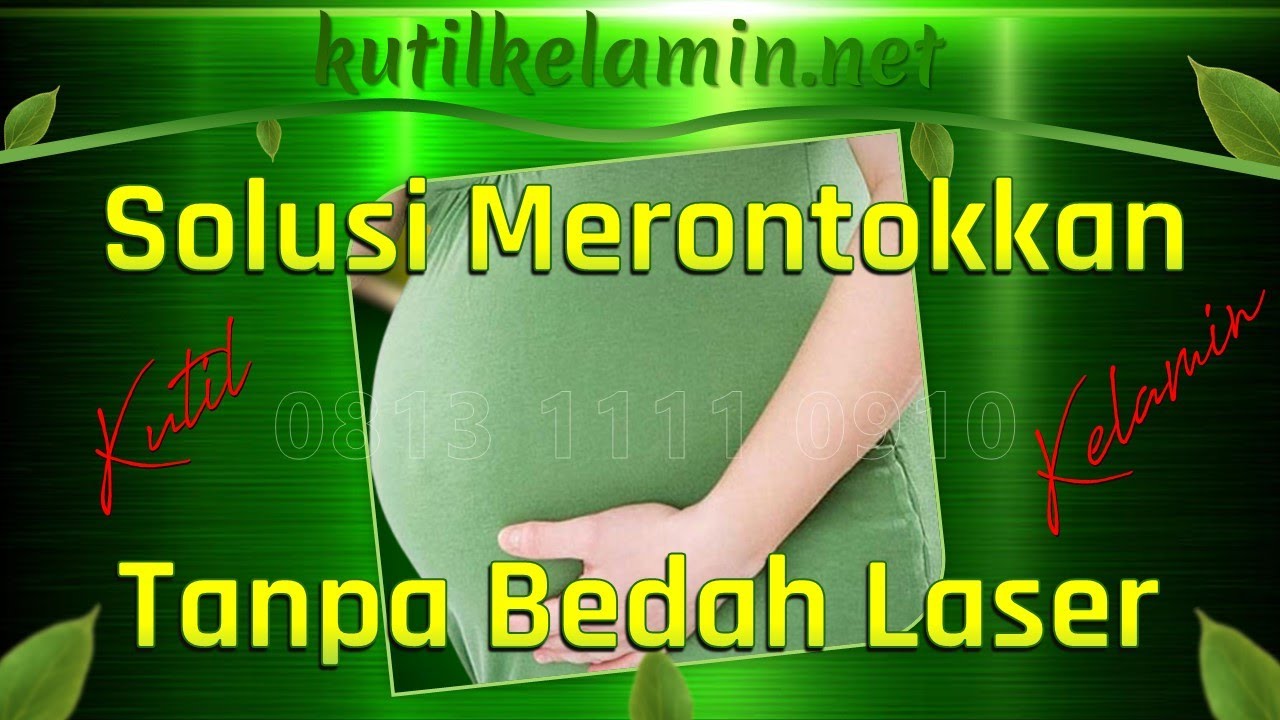 Cara Merontokan Kutil Kelamin Pada Wanita Hamil Dapat Dilakukan Tanpa ...