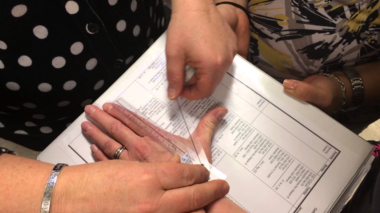 Thumb Radial Abduction - YouTube