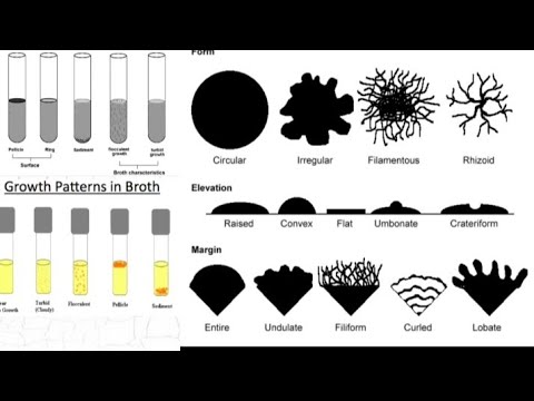 Growth characters of bacteria on agar plate , agar slant and nutrient ...