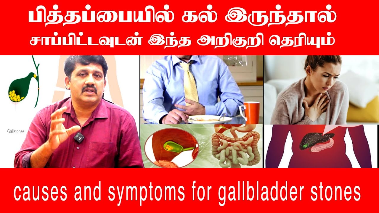 பித்தப்பையில் கல் ..யாருக்கு வரும் ? || causes and symptoms for ...