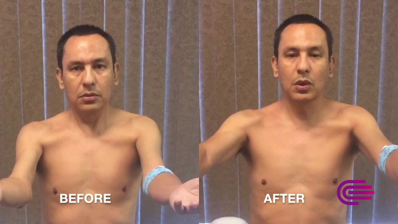 David Front before after - YouTube