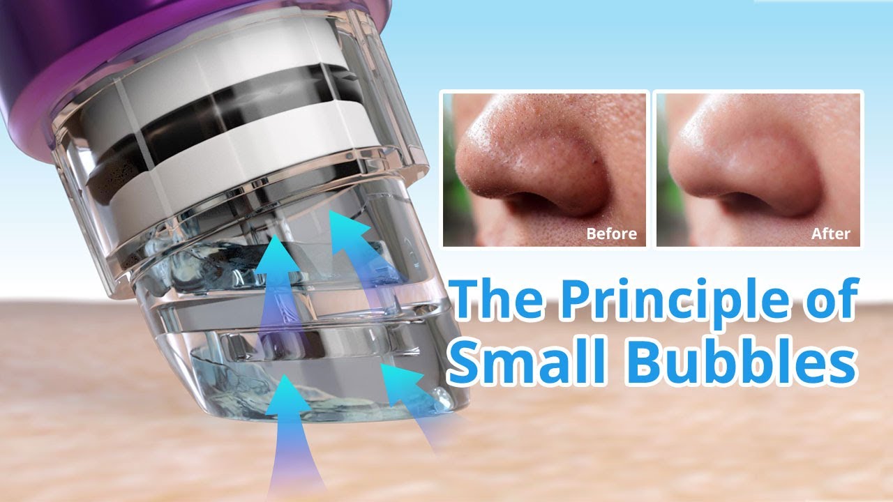 Principle Video of Small Bubbles|#skincare#smallbubble#skinrejuvenation ...