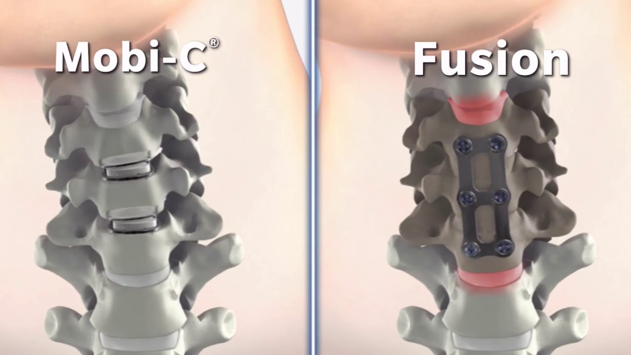 7.) The Mobi C Advantage - YouTube