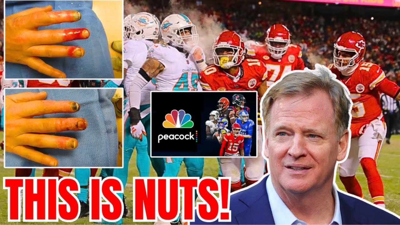 NFL Fans Facing AMPUTATIONS after SUB FREEZING Chiefs Peacock Playoff ...