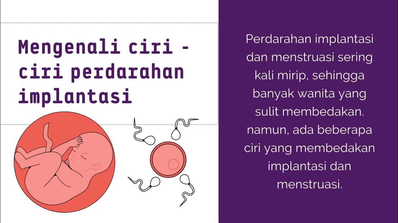 perbedaan antara perdarahan implantasi dan menstruasi♥️ - YouTube