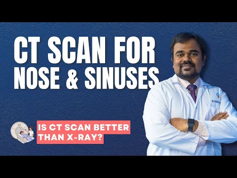 Will A Ct Scan Show Nasal Polyps
