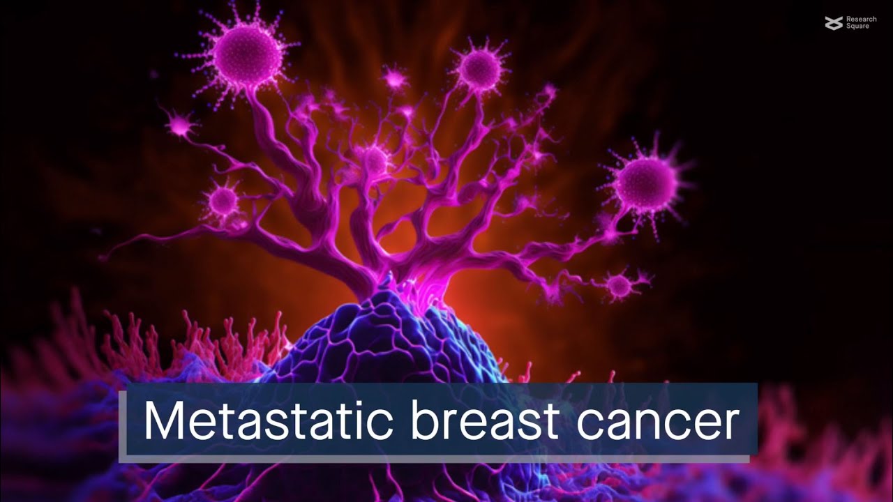 Unraveling the cell cell communication characteristics driving breast ...
