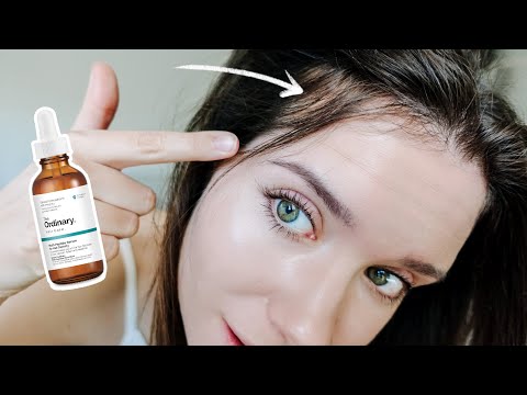 The Ordinary Multi Peptide Serum for Hair Density - 3 Month Update