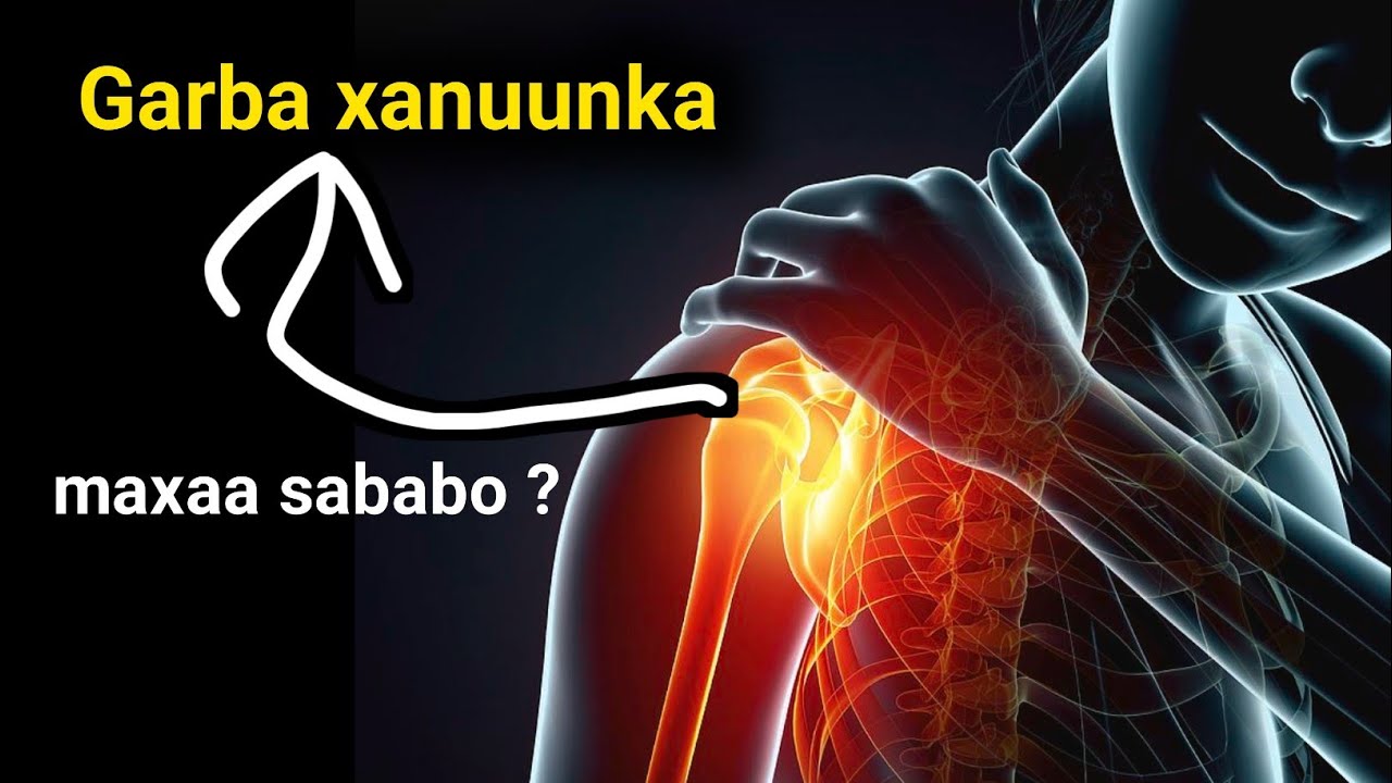 Garbaha xanuun Maka dareentaa iyo feeraha ? Calaamadahaan hadii ee kuu ...