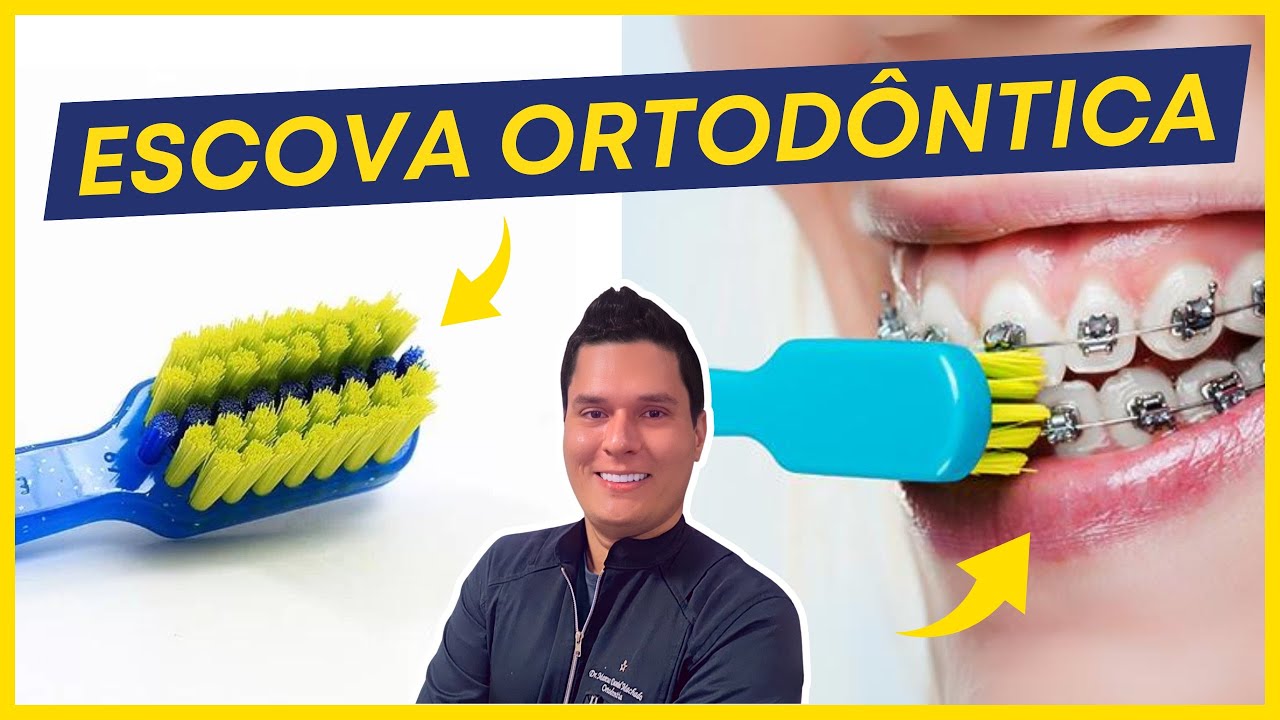 ESCOVA ORTODÔNTICA : COMO USAR DO JEITO CERTO? - YouTube