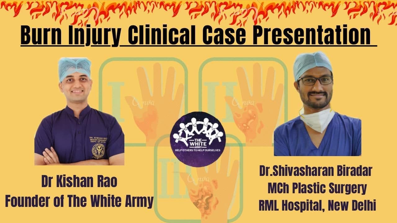 BURN INJURY case presentation - YouTube