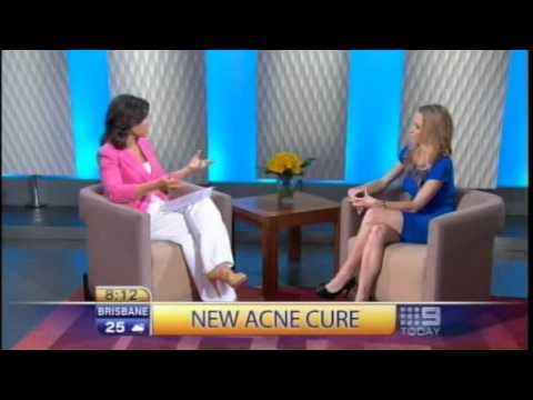Acting on Acne with Dr. Natasha Cook - YouTube
