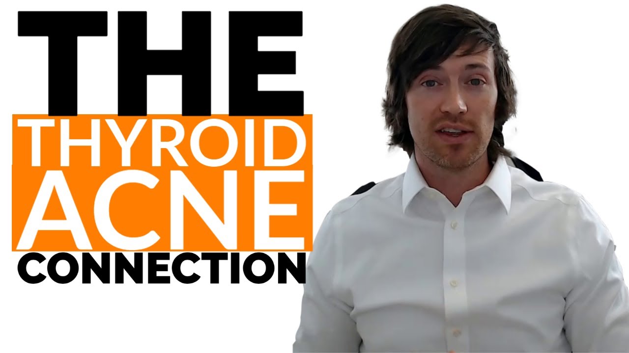How Thyroid Problems Cause Acne (& How to Clear Your Skin) - YouTube
