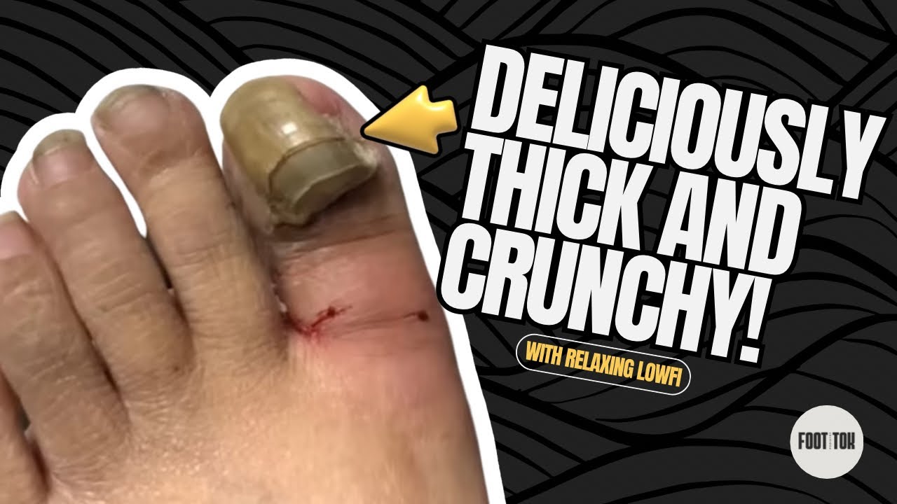 Highly Sensitive Toenail Cutting w/ Dr Kim (Holistic Foot Doctor) - YouTube