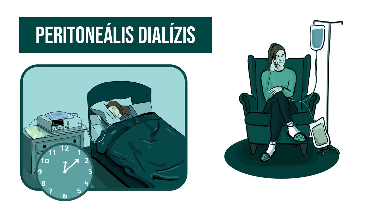 Peritoneális dialízis – oktatófilm és interjú - YouTube