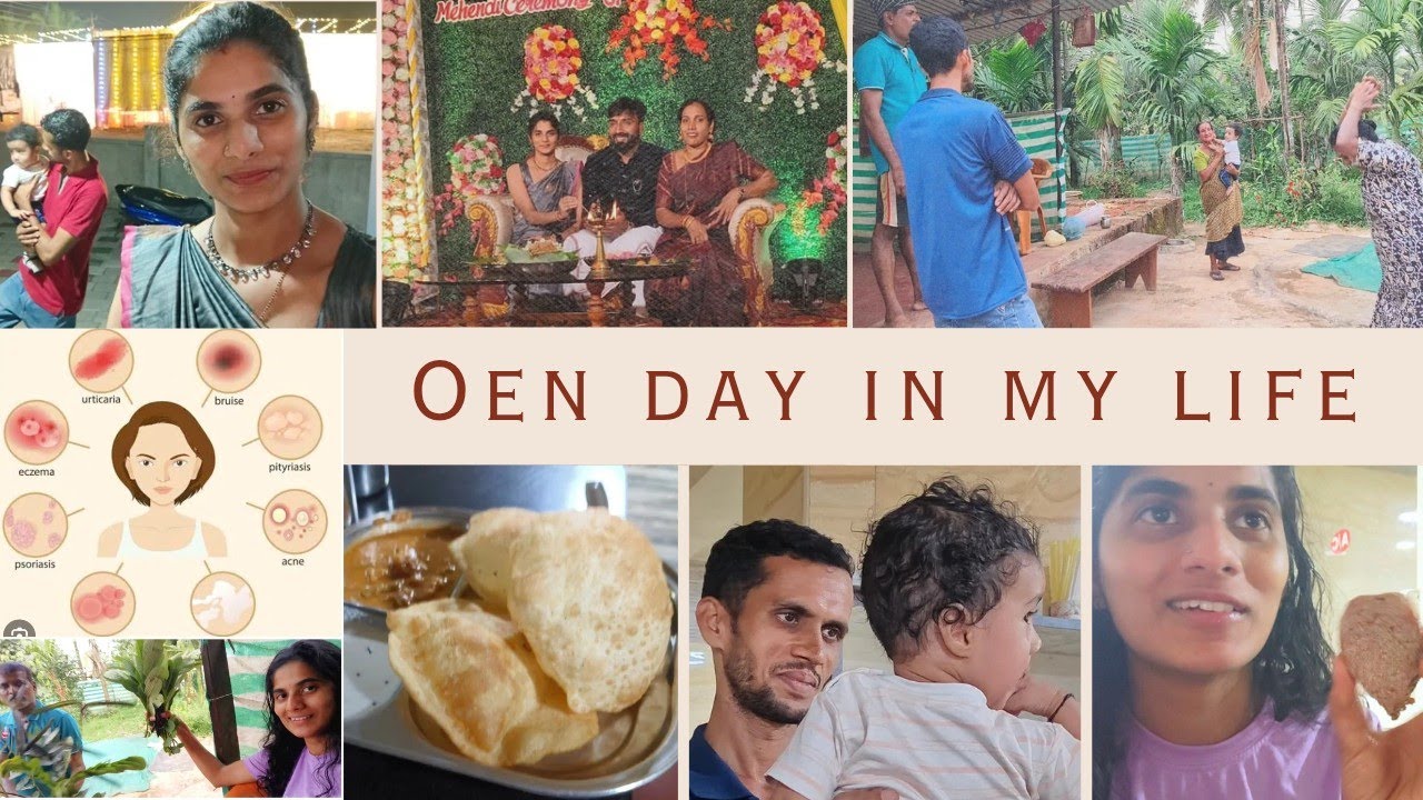 mehedi ceremony ️/ovve skin problemg ಈ ತಪ್ಪು ಉಪಯೋಗ ಆಪುಂಡುಗೆ🎋ಹೊಟೇಲ್ ...