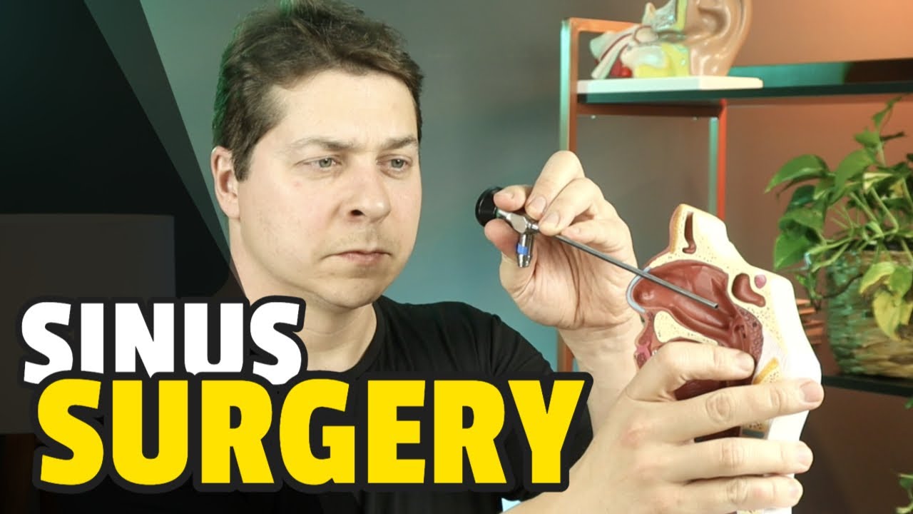 watch a sinusotomy surgery and learn about it - YouTube