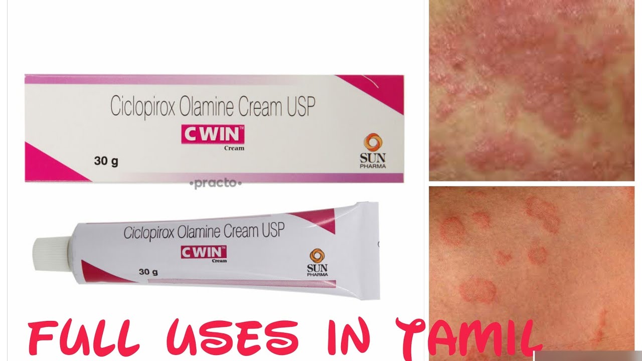 Cwin cream uses in tamil with english sub titile @bala green channel ...
