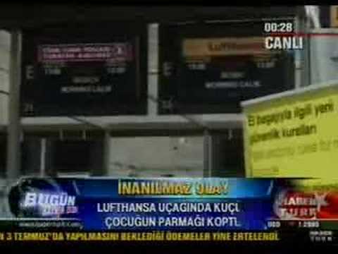 Ekrem Kılıç'ın kopan parmağı