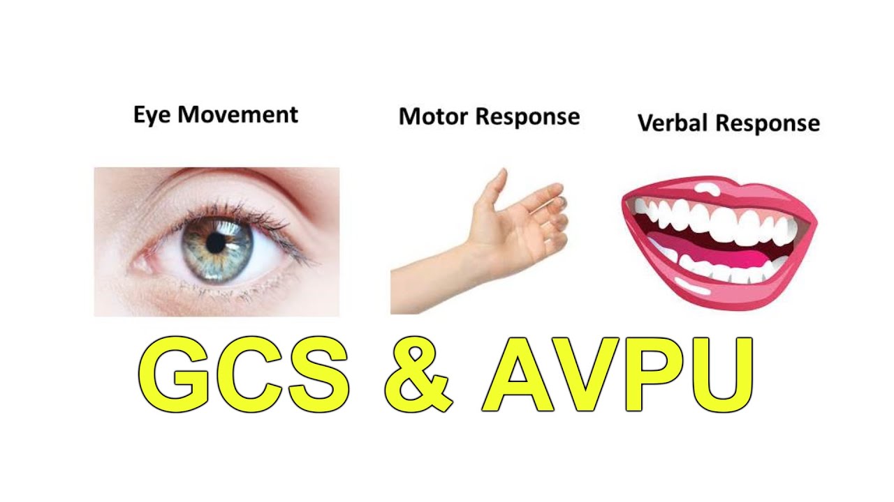 Komponen Pemeriksaan Tingkat Kesadaran : GCS dan AVPU - YouTube