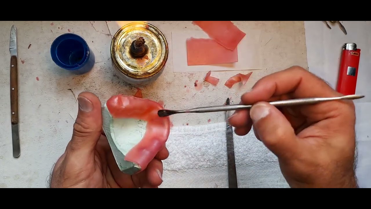PROTESIS FIJA. Alivios de cera para CUBETA INDIVUDUAL. 1er parte. - YouTube