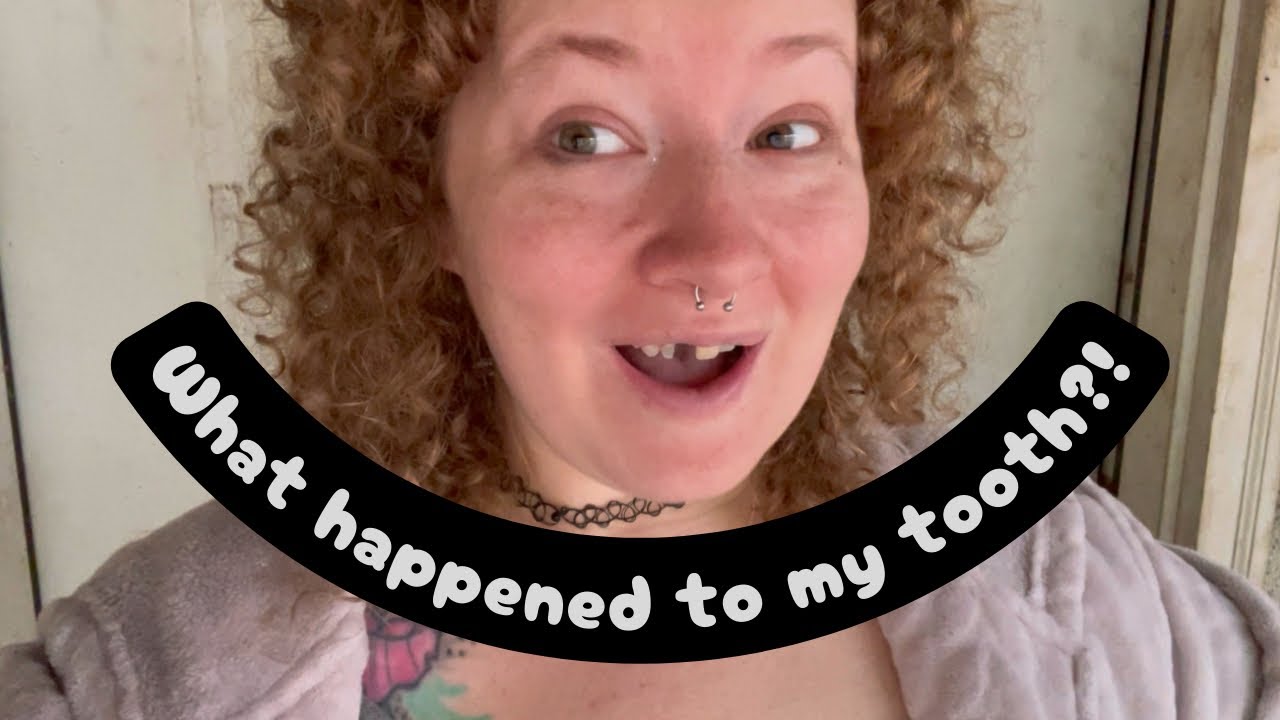 What happened to my tooth?! Why is it missing? #insecurities #beauty ...