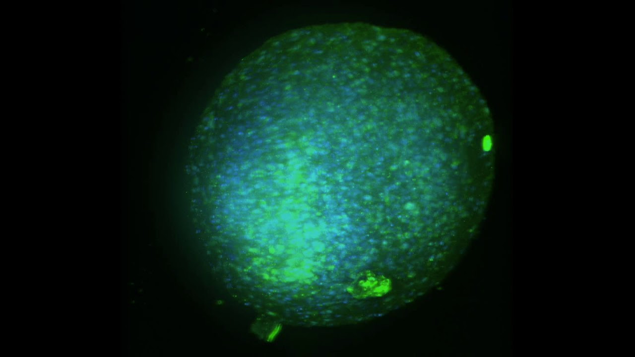 Neuronal Organoid: Synapsin I Labeling and Tissue Clearing - YouTube