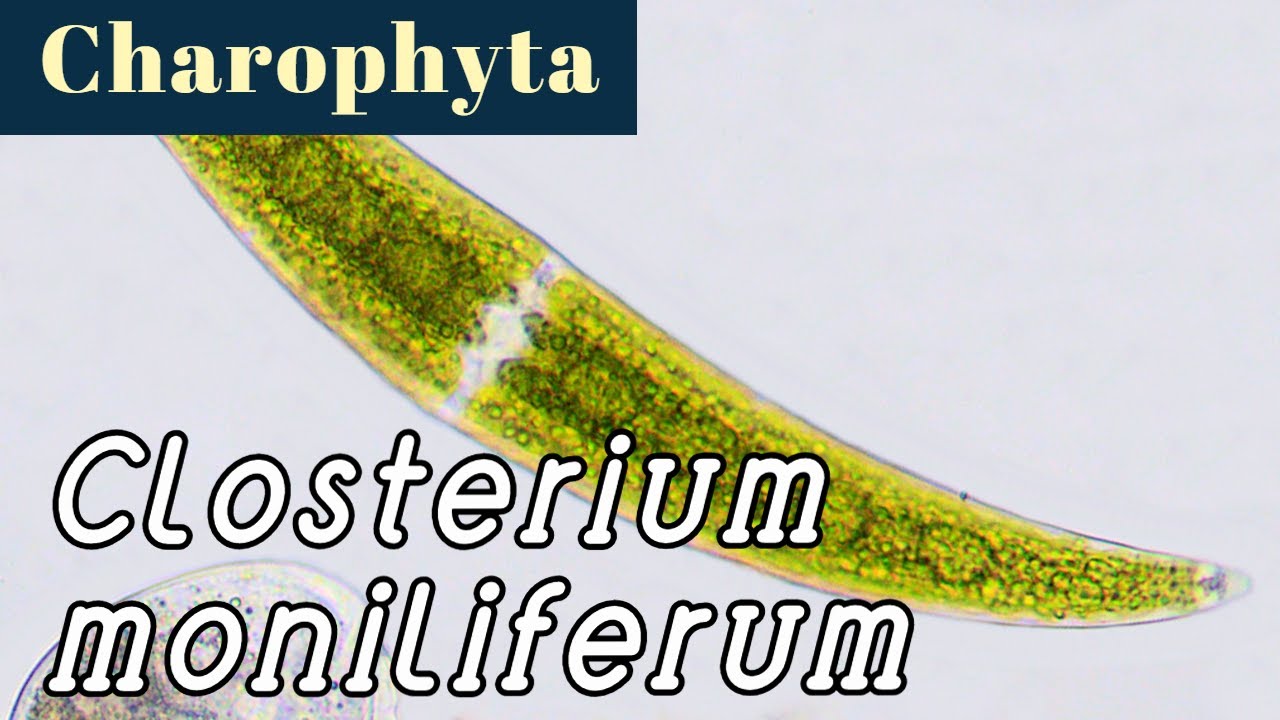 Closterium moniliferum (Charophyta or Green Algae) - YouTube