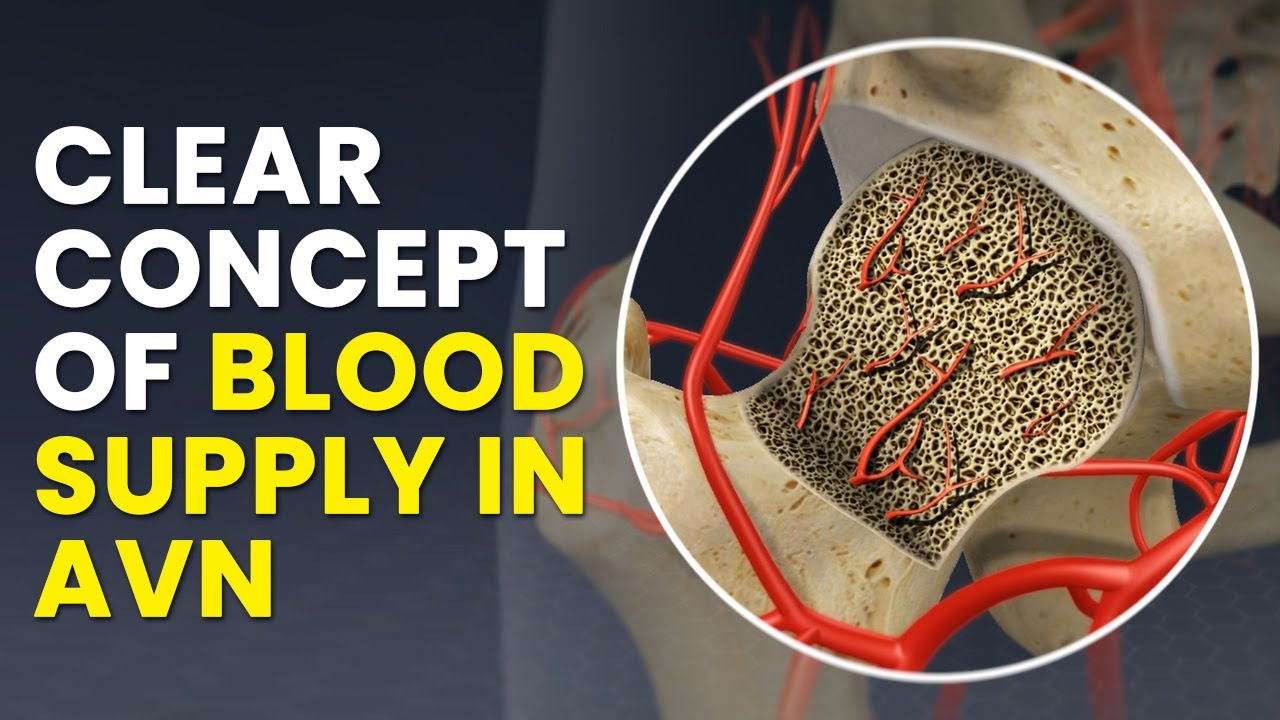 AVN में ब्लड सप्लाई कैसे होती है How does blood flow in the hip joint ...
