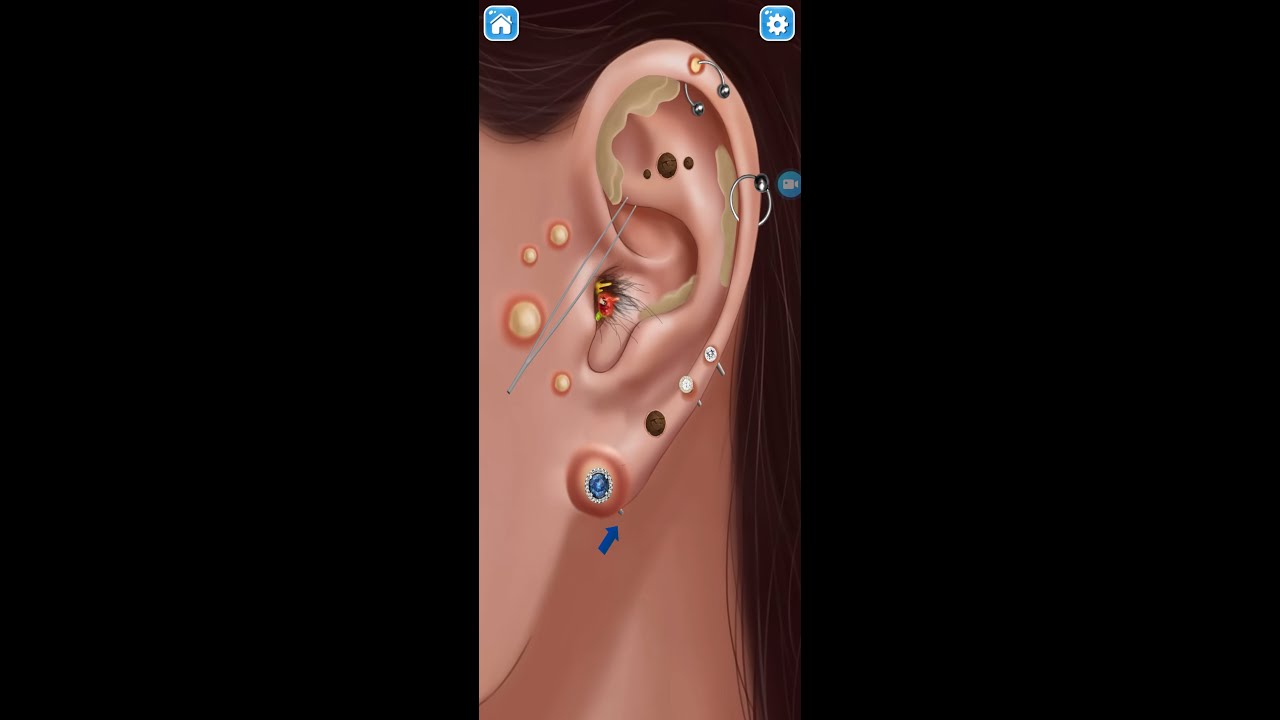 Asmr animation Satisfying video Relax Clean Ear Piercing Treatment ...