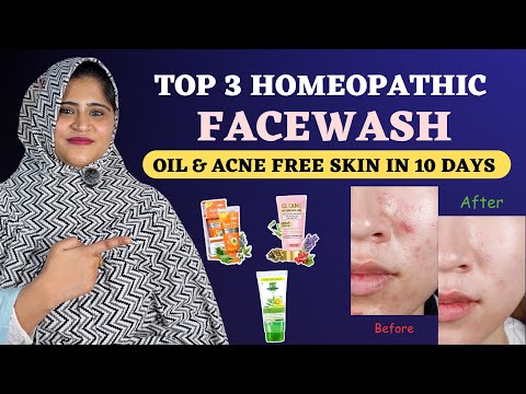 Homeopathic Facewash for Oily Skin | Removes Oil, Treat Acne Pimples in 10 days (Under Rs. 200)
