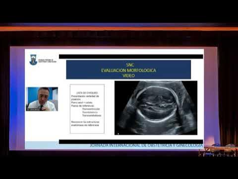 Ecografía Morfológica Evaluación del SNC Minray Peru Dr Jaime Arenas Gamboa - YouTube