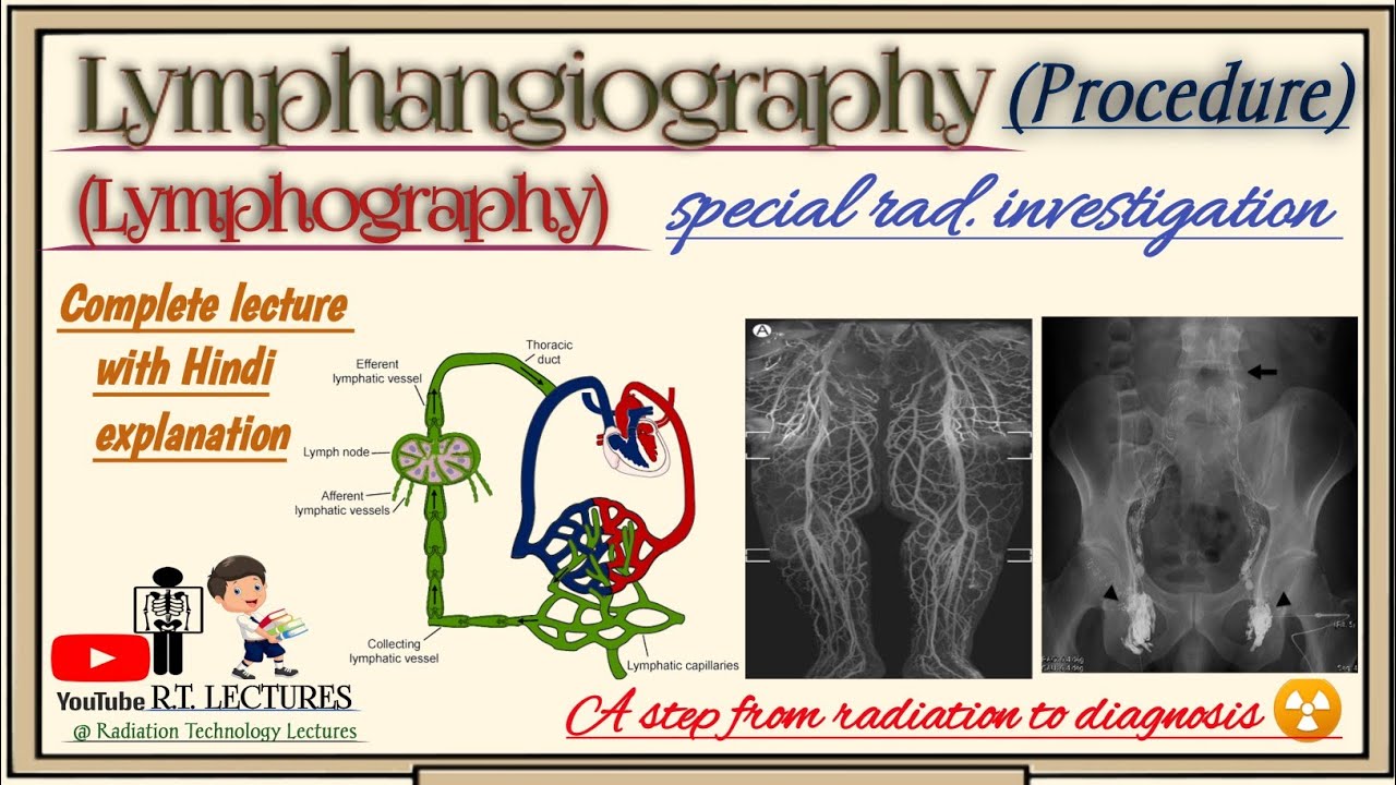 #Lymphangiography /Lymphography special investigation in hindi # ...