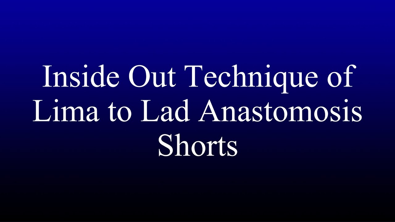 LIma to LAD Anastomosis: Inside Out Technique shorts - YouTube