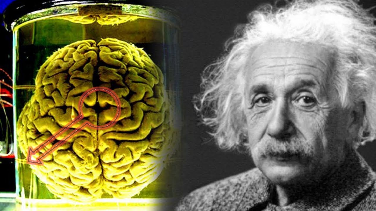 Unlocking Einstein's Brain: What Made Him a Genius? - YouTube