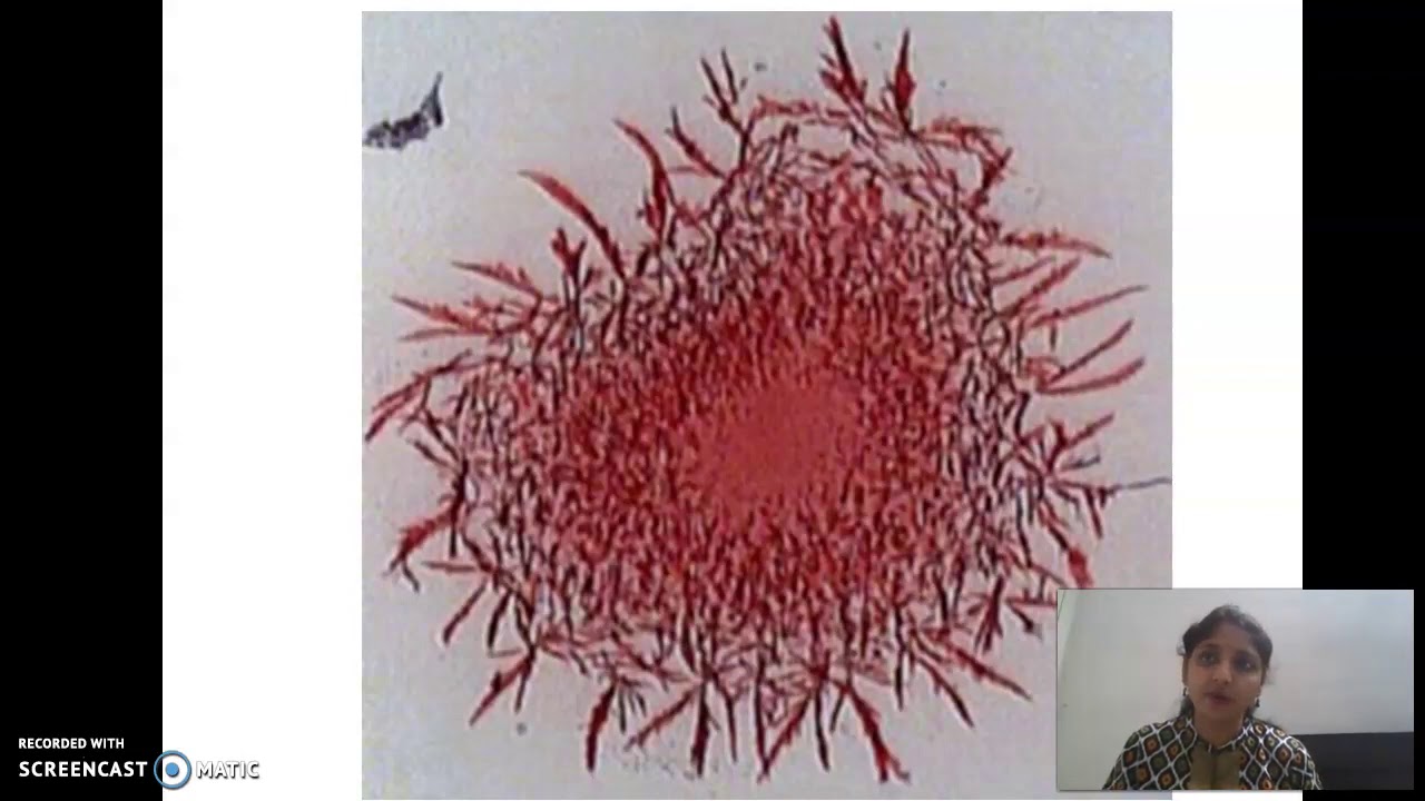 Preparation of Haemin and Hemochromogen crystals - YouTube
