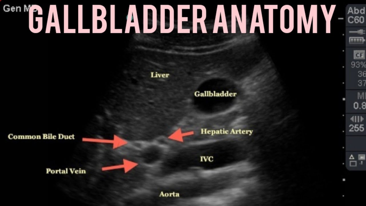 Gallbladder sonographically appearance #for you #sccaning technique ...
