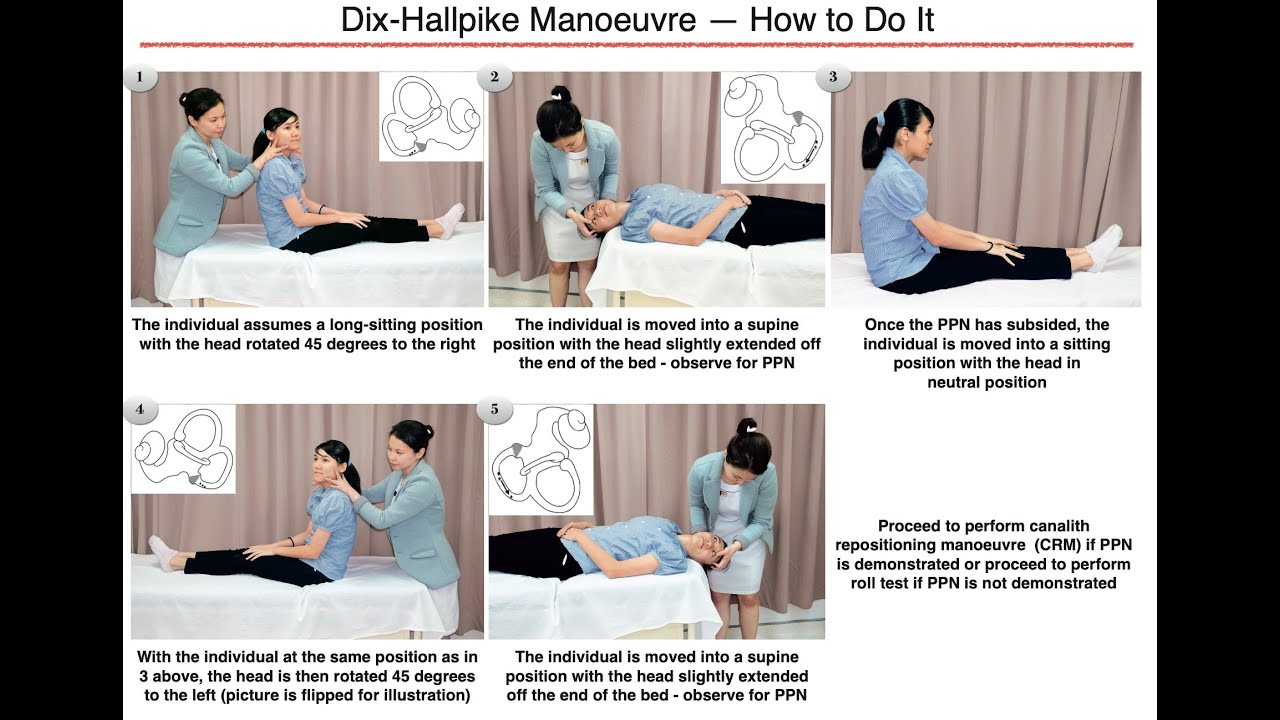 Left Dix-Hallpike Manoeuvre - How to Do It - YouTube