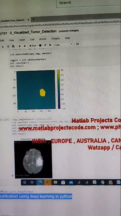 Brain tumor detection and classification using deep learning in python - YouTube