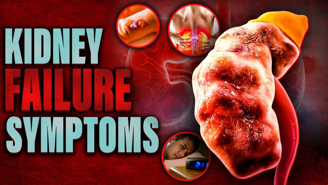 Early Signs & Symptoms Of Kidney Failure Everyone Needs To Know ...