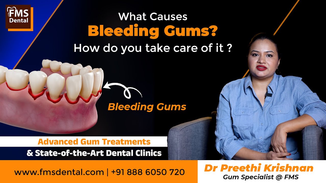 Bleeding Gums? Causes, Symptoms & Best Treatment Options | FMS Dental ...
