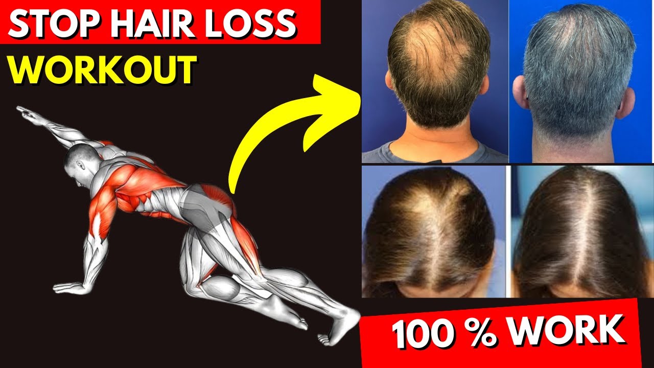Workout for Hair Loss Treatment - YouTube