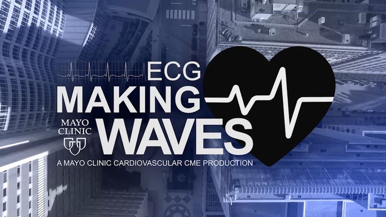 Evolution of Computerized ECG Interpretation - YouTube